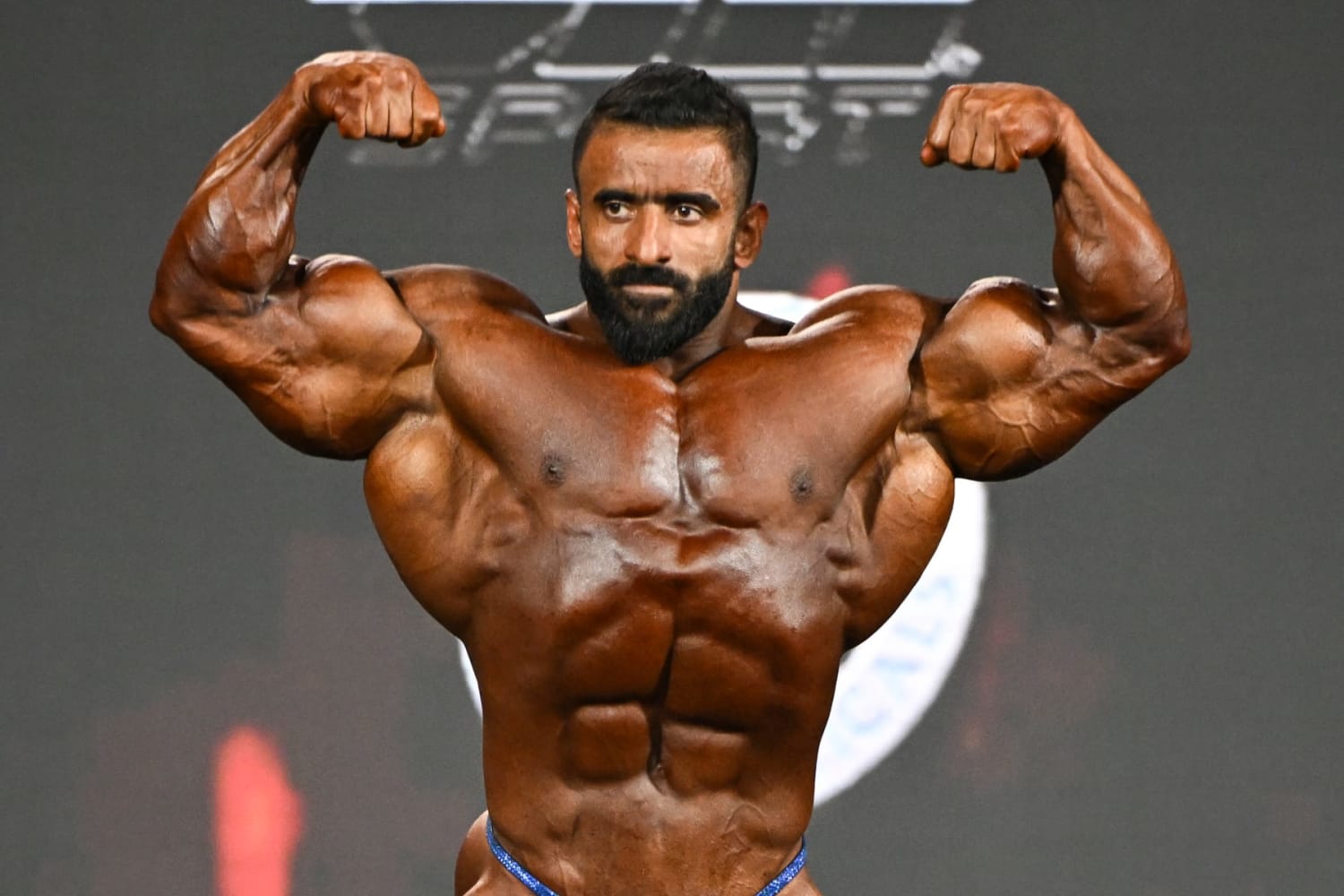 Revealed: Who Won the Mr. Olympia 2024 Title?